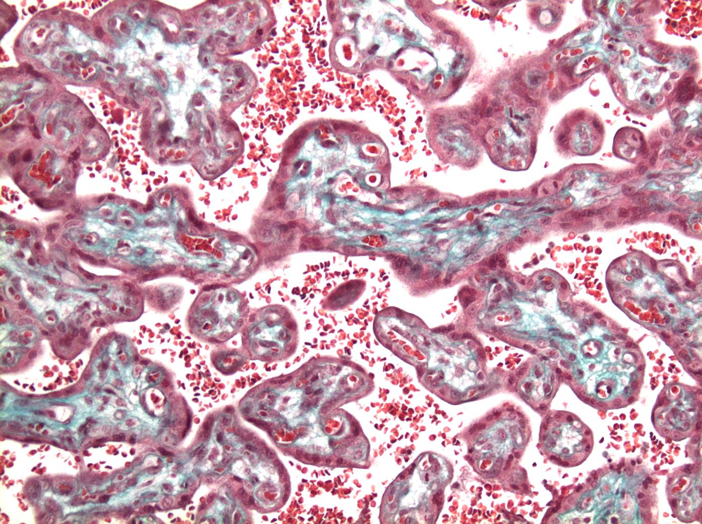Research – Serghides Lab